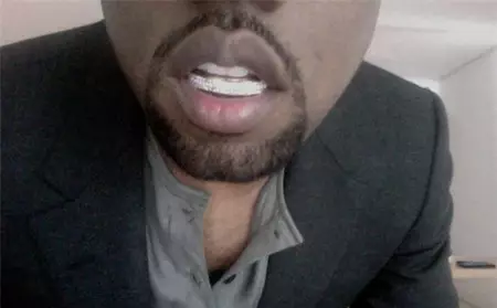 Mga ngipin ng brilyante ng Kanye West