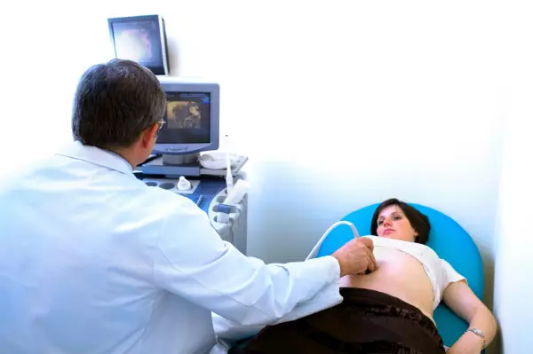 4D ultrasound