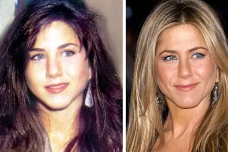 Plastická operácia Jennifer Aniston